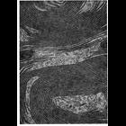 Cell Type | Acinar cell