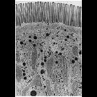 Cell Type | Brush border epithelial cell