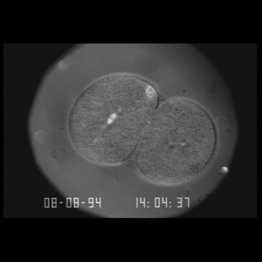 CIL:11943, Lytechinus, early embryonic cell. CIL. Dataset