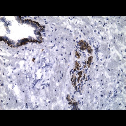 CIL:32658, Homo sapiens, endocrine-paracrine cell of prostate gland ...