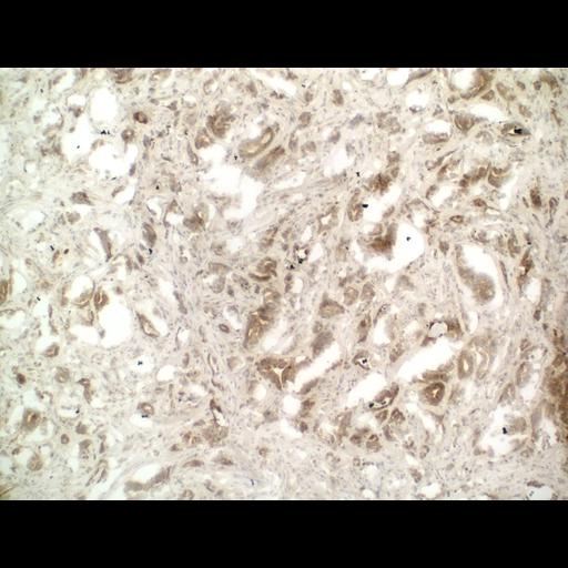 CIL:33211, Homo sapiens, endocrine-paracrine cell of prostate gland ...