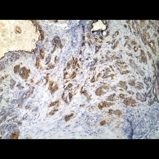 CIL:33512, Homo sapiens, endocrine-paracrine cell of prostate gland ...