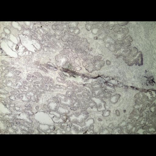 CIL:33864, Homo sapiens, endocrine-paracrine cell of prostate gland ...