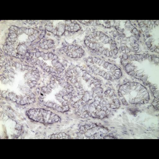 CIL:33866, Homo sapiens, endocrine-paracrine cell of prostate gland ...