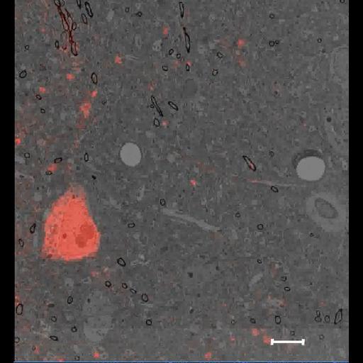 CIL:50401, Mus musculus, Mouse brain tissue, Mouse brain tissue ...